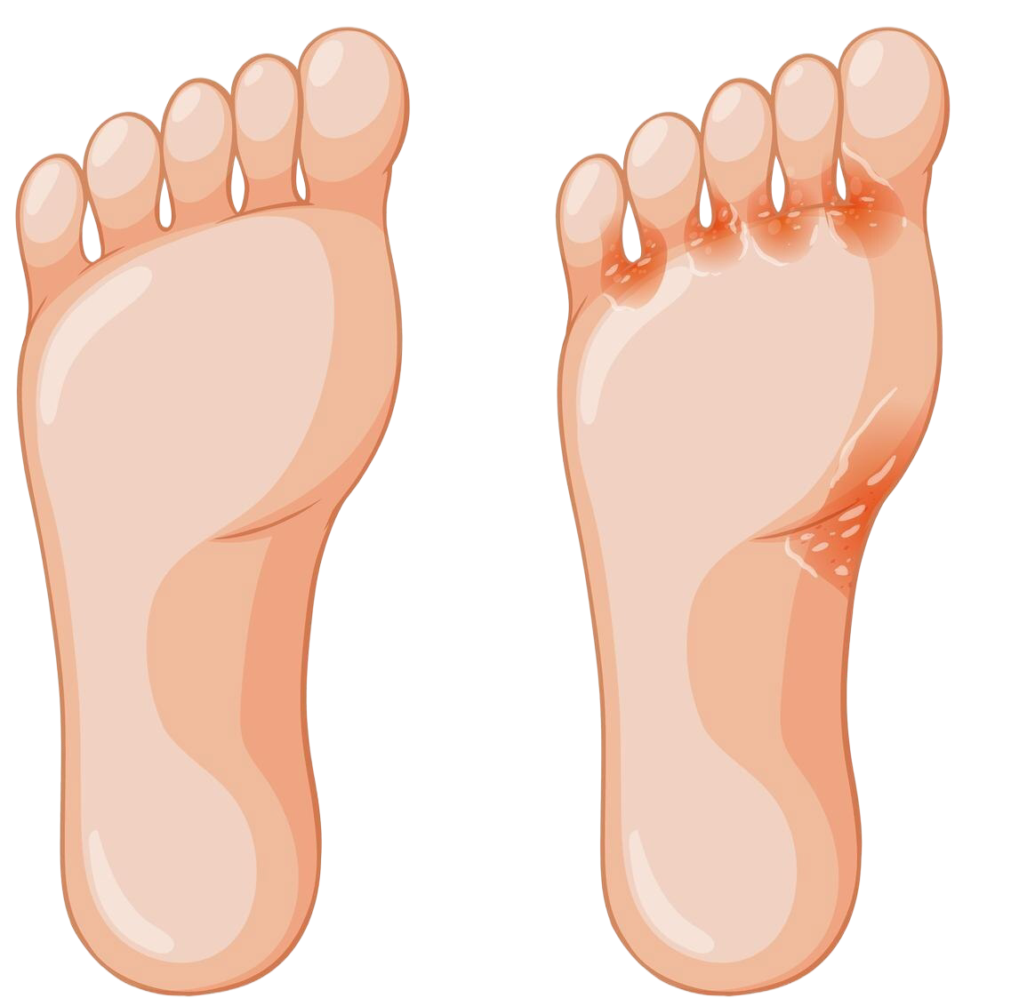 Conditions We Treat – Bunions, Heel Pain & More in Murfreesboro